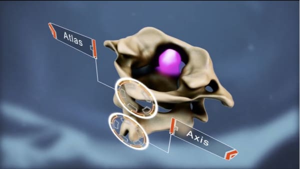 Le rachis cervical - Espace Francilien du Rachis | Versailles & Paris